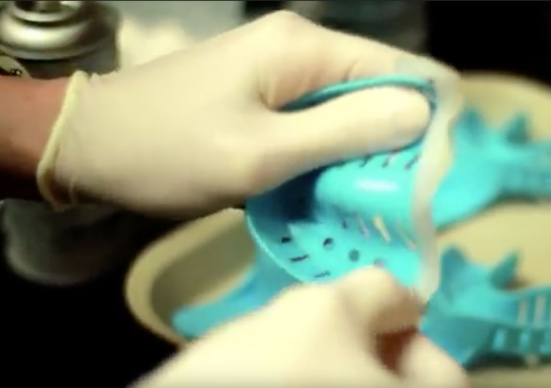Taking A GREAT Alginate Impression - Naperville Dental Specialists