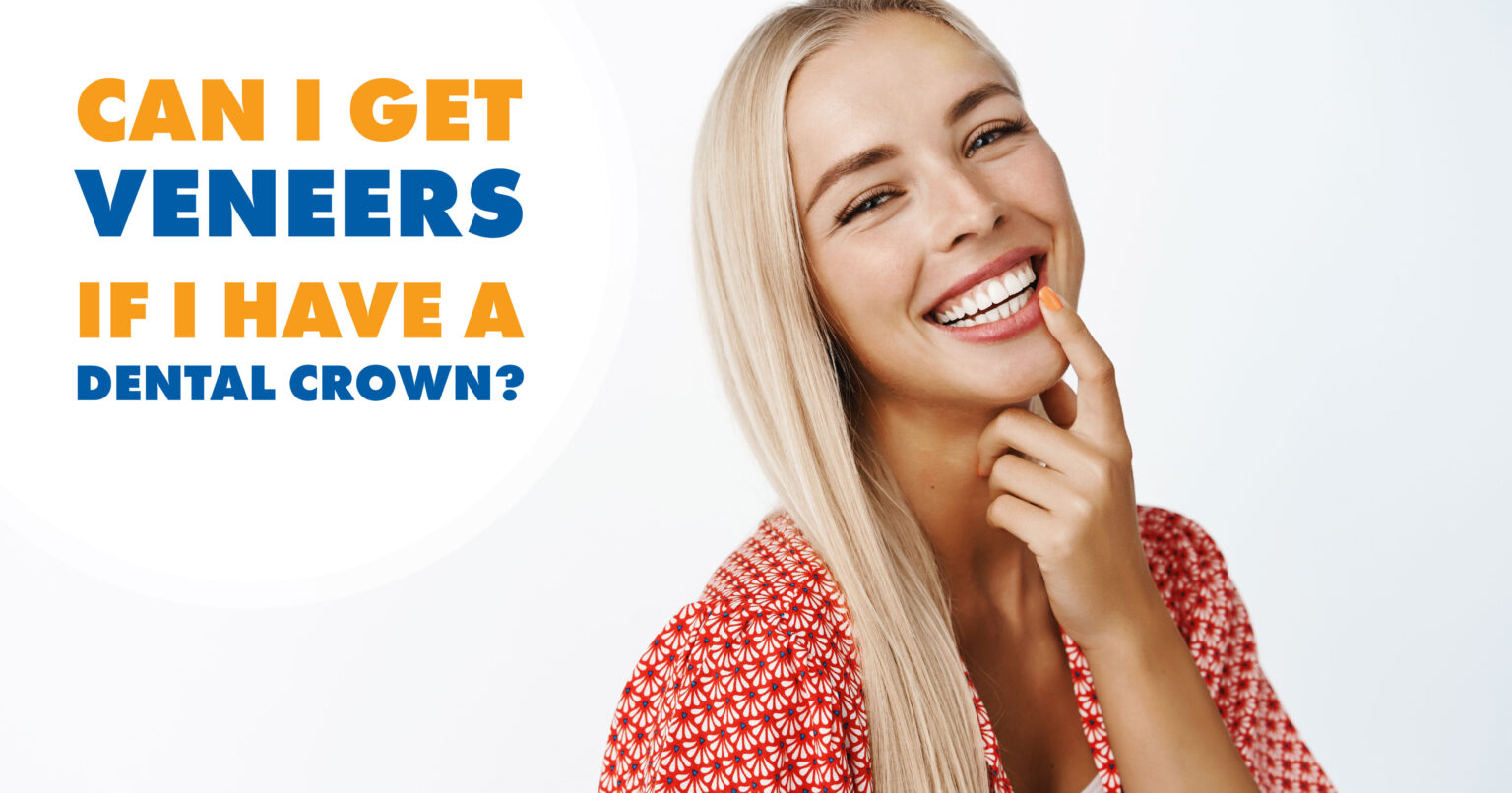 Can I Get a Veneers Over Crowns? A Quick Guide